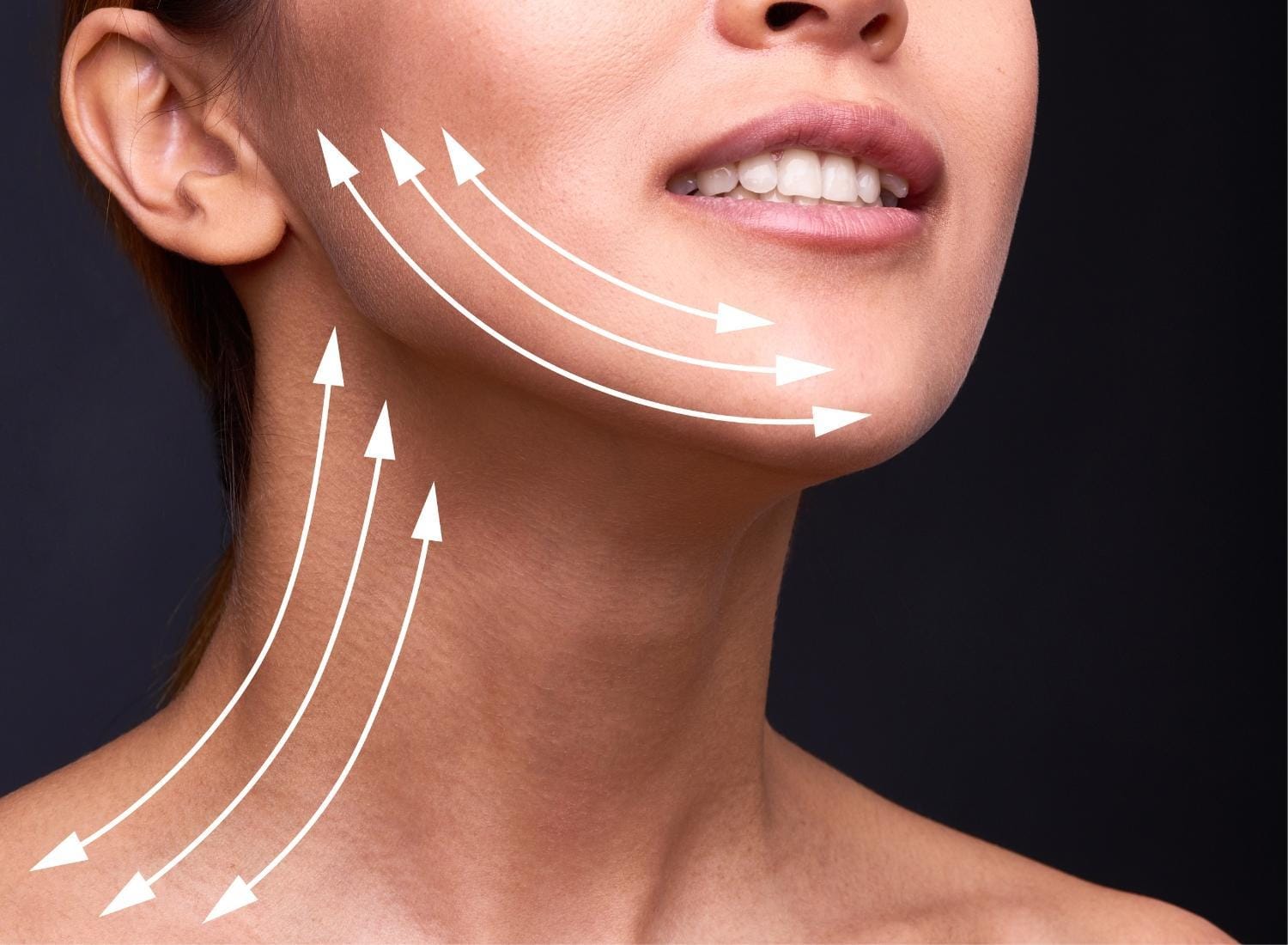 Lifting Nefertiti cu Botox Bucuresti | UltraEstetic Cotroceni